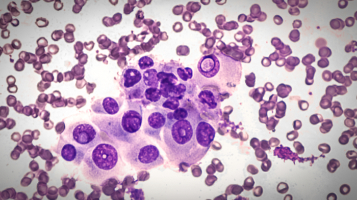 Understanding Cancer Cells as Clusters, Not Individuals - Giving Compass Understanding Cancer Cells as Clusters, Not Individuals - Giving Compass