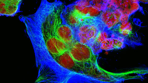 New Research Shows the Deadly Effect of Neurons on Cancerous Tumors ...