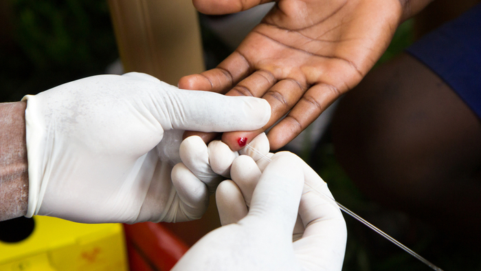 Nurses Lead Ghana’s Drive to Fast Track Malaria Diagnosis Using Rapid ...